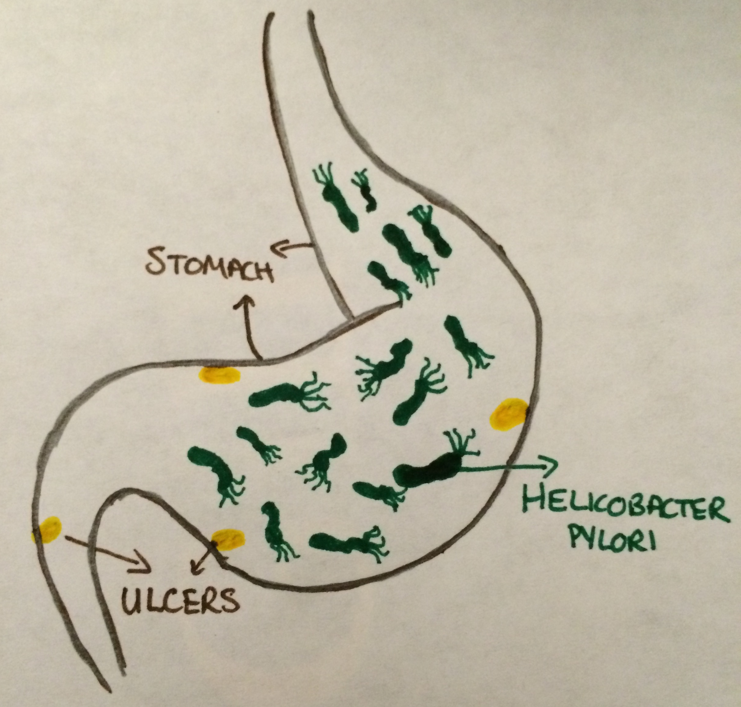 Helicobacter pylori | Mechanisms of Pathogenicity