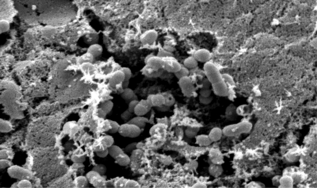 Streptococcus suis | Mechanisms of Pathogenicity