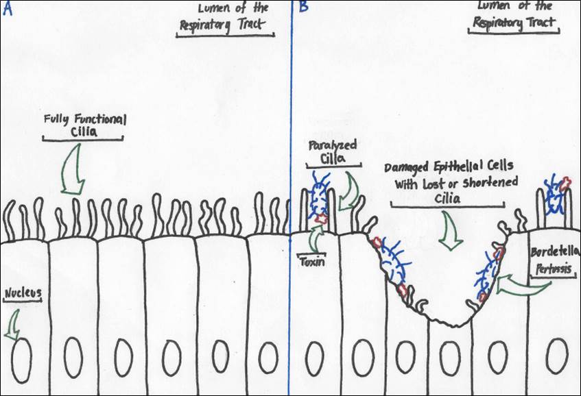 Bordetella pertussis | Mechanisms of Pathogenicity