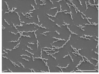 Campylobacter jejuni | Mechanisms of Pathogenicity