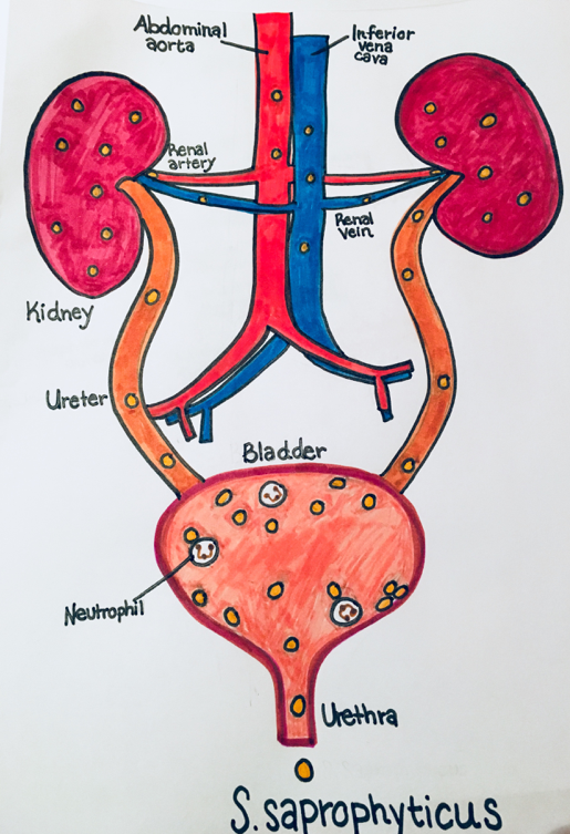 Staphylococcus saprophyticus | Mechanisms of Pathogenicity