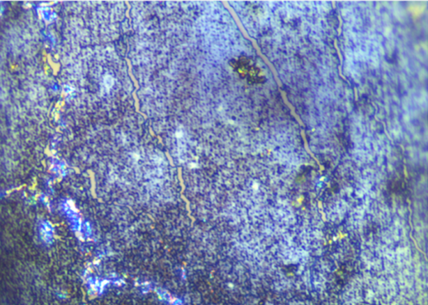 Proteus mirabilis | Mechanisms of Pathogenicity